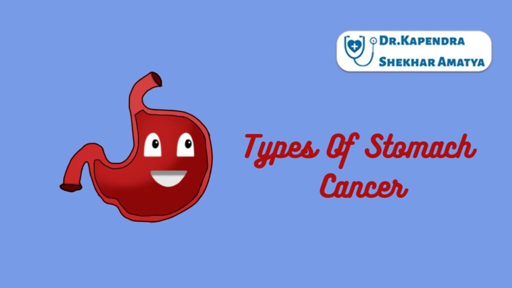 Types-Of-Stomach-Cancer - Dr. Kapendra Shekhar Amatya